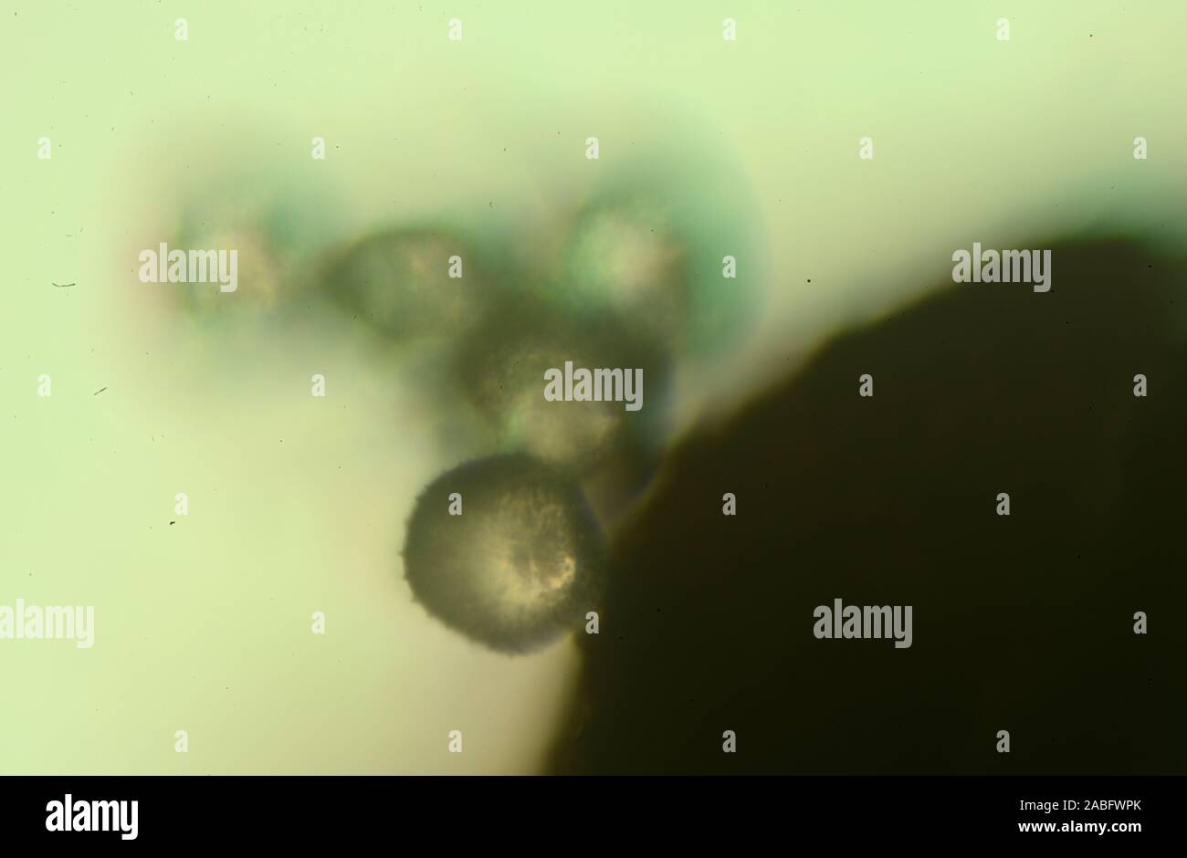 Pollen is a fine to coarse powdery substance comprising pollen grains ...