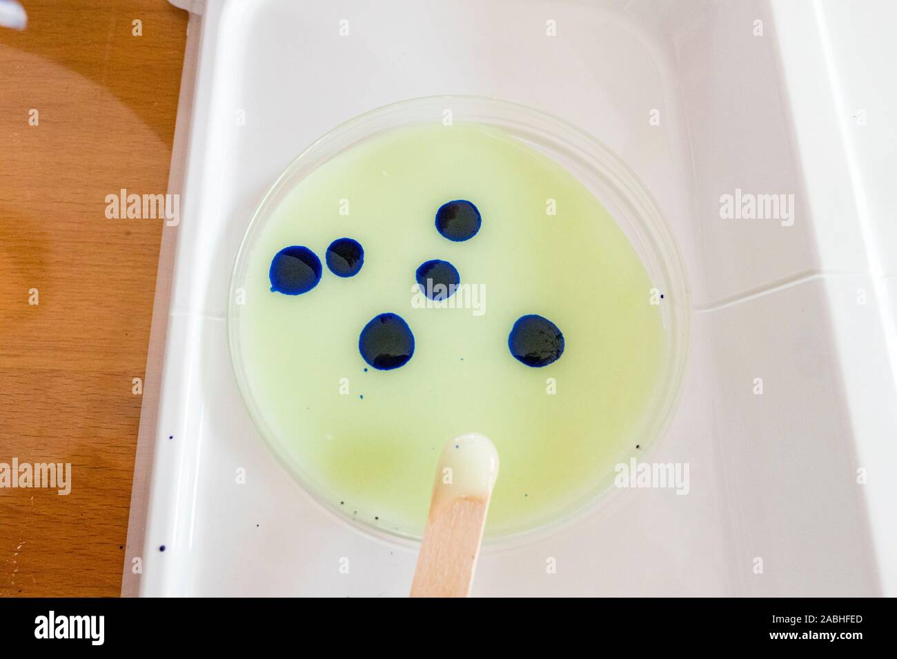 labor test culture with blue points Stock Photo - Alamy
