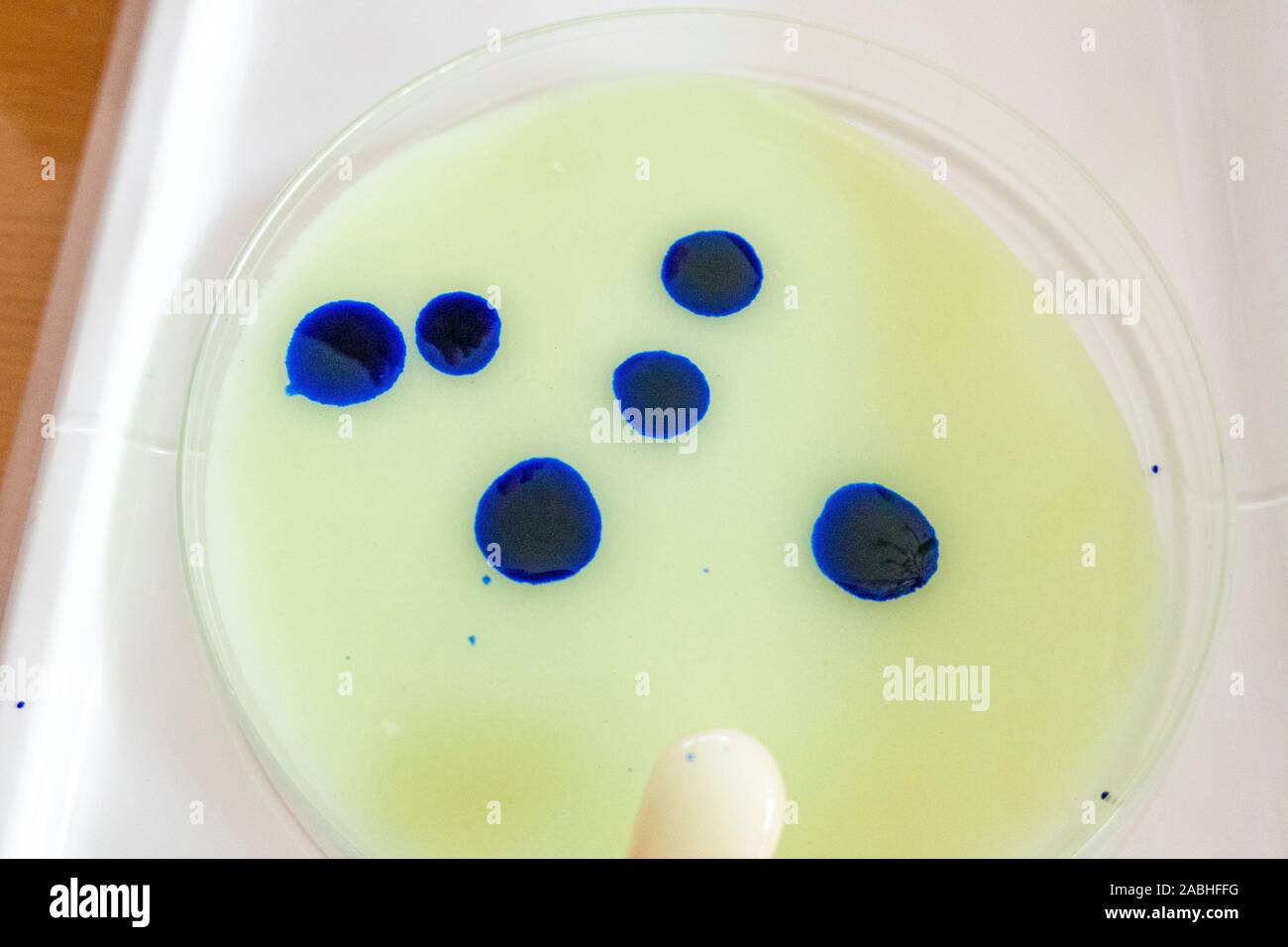 labor test culture with blue points Stock Photo - Alamy