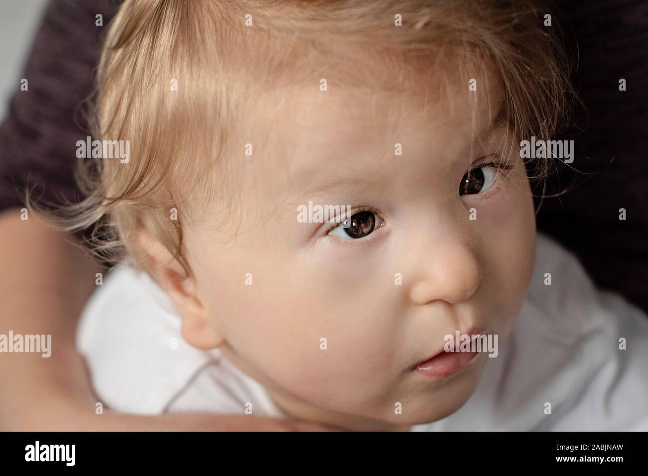 Portrait of a baby with cerebral palsy lying on bed. Special needs ...