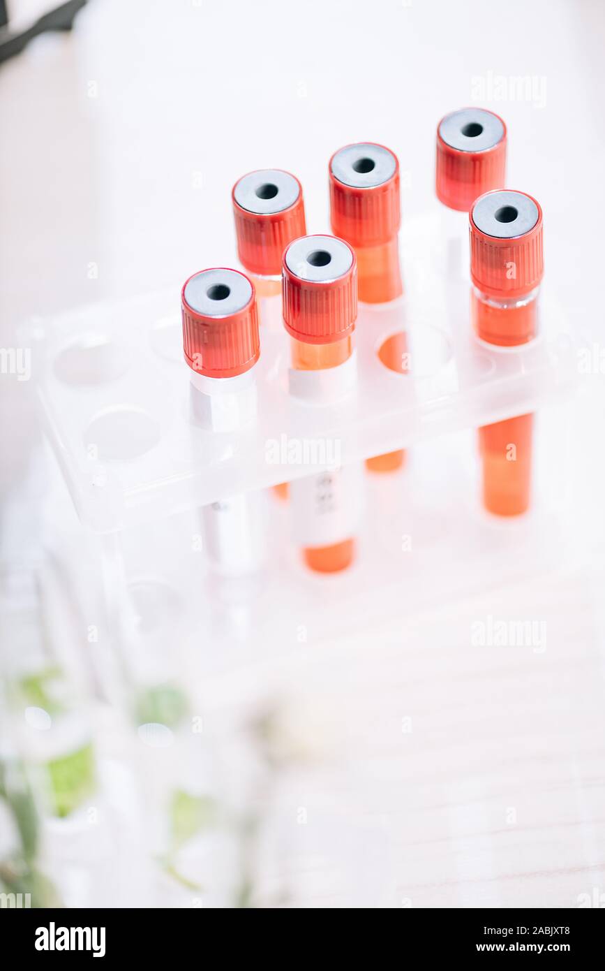 Test immuno hi-res stock photography and images - Alamy