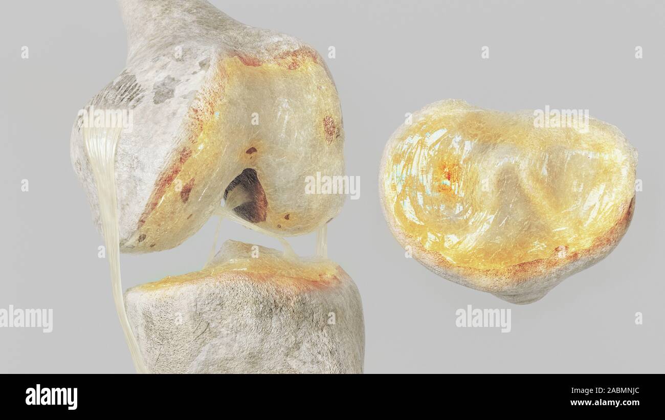 Bone spurring hi-res stock photography and images - Alamy