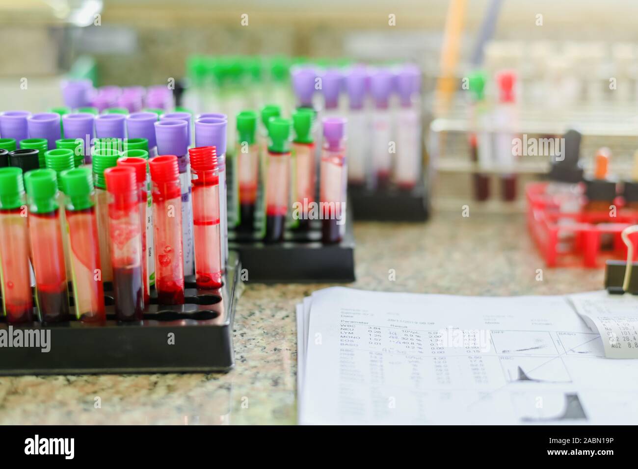 Test tube blood plasma hi-res stock photography and images - Alamy