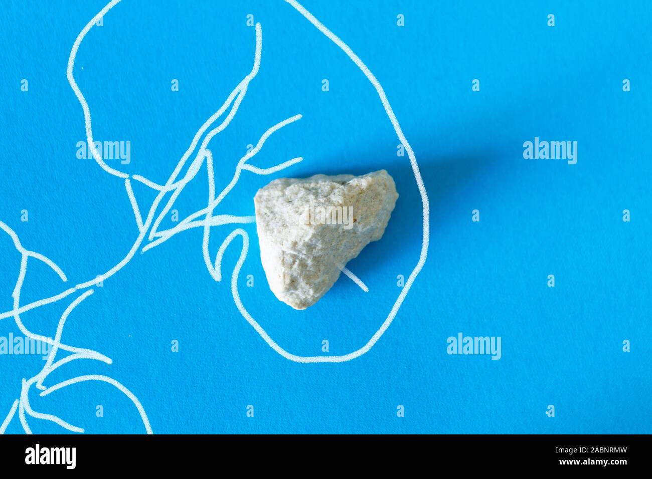 Kidney stone illness concept. Drawing of kidney band real stone Stock ...