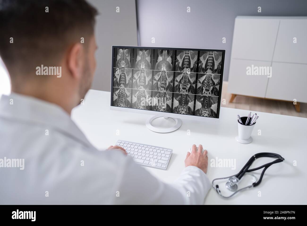 Xray of the lumbar spine hi-res stock photography and images - Alamy