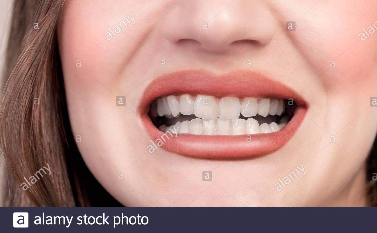 Gums Mouth High Resolution Stock Photography and Images - Alamy