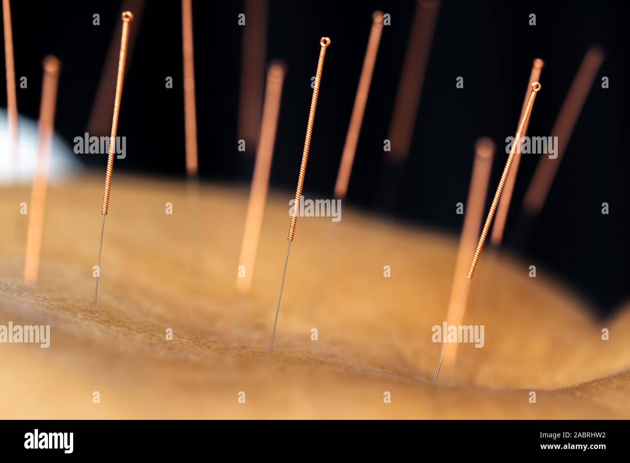Close-up of senior female back with steel needles during procedure of ...