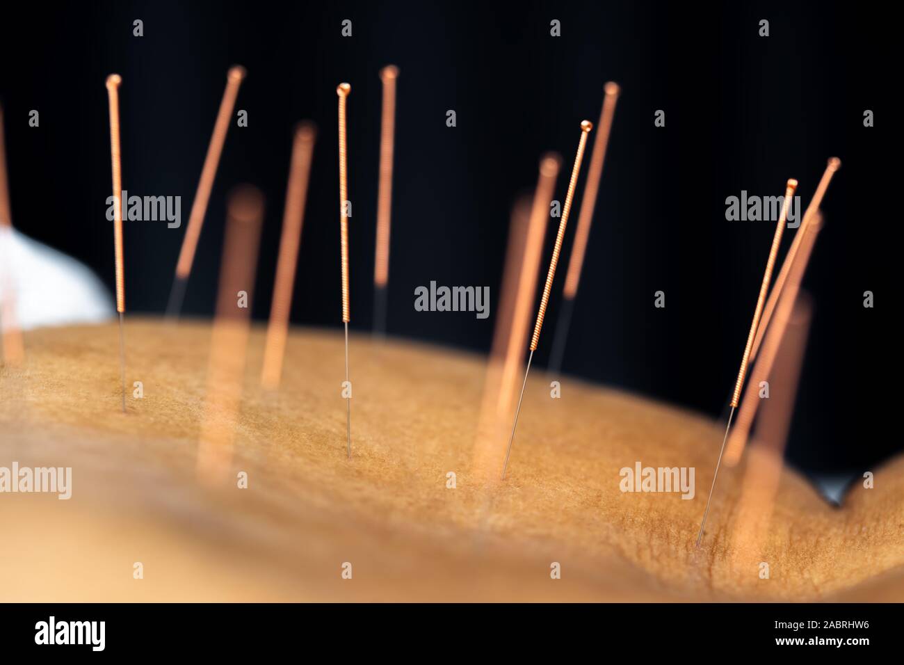 Acupuncture procedure hi-res stock photography and images - Alamy