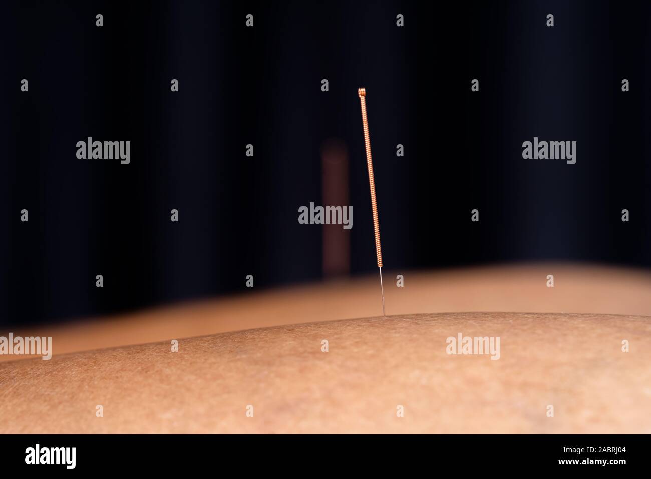close up therapy of leg with pricking acupuncture needles Stock Photo ...