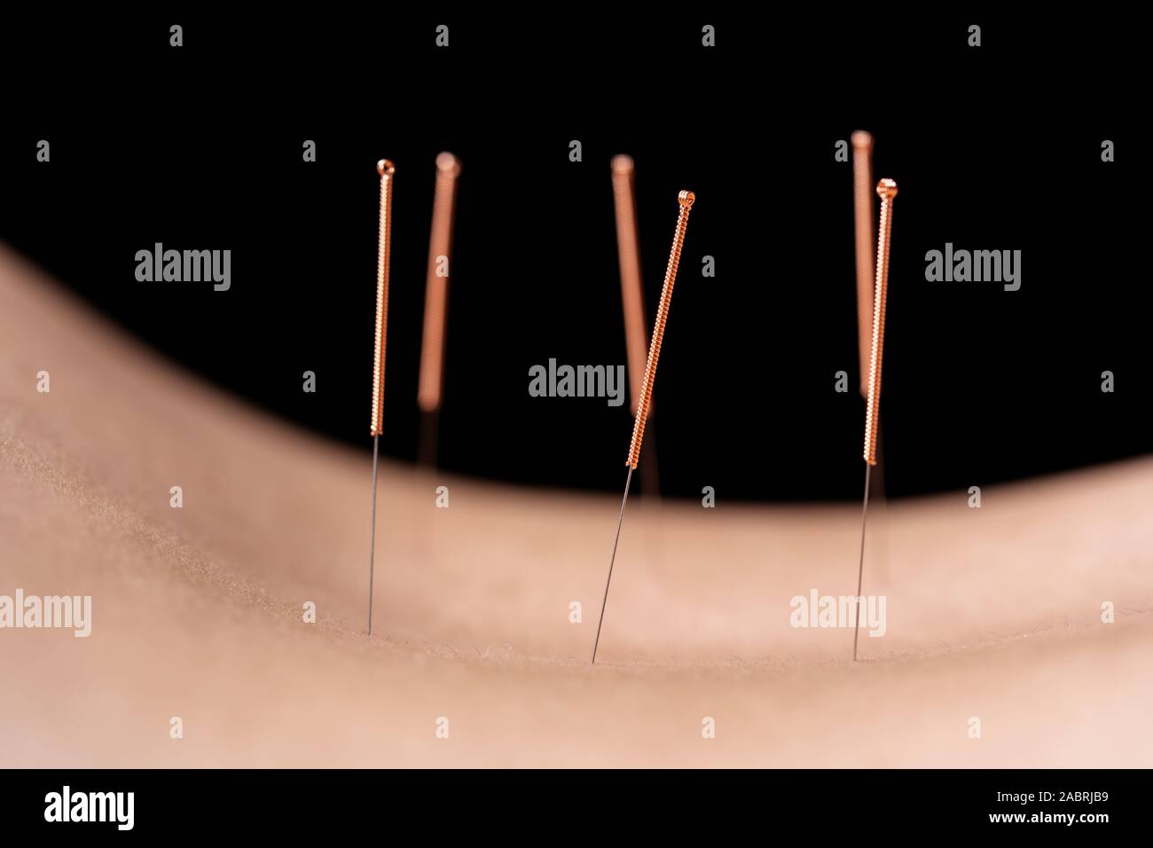 Doctor holding acupuncture needles hi-res stock photography and images ...