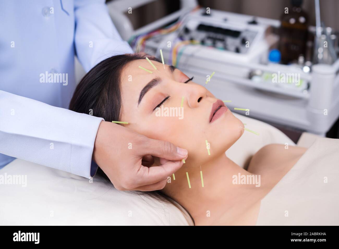 Asian woman undergoing acupuncture beauty hi-res stock photography and ...