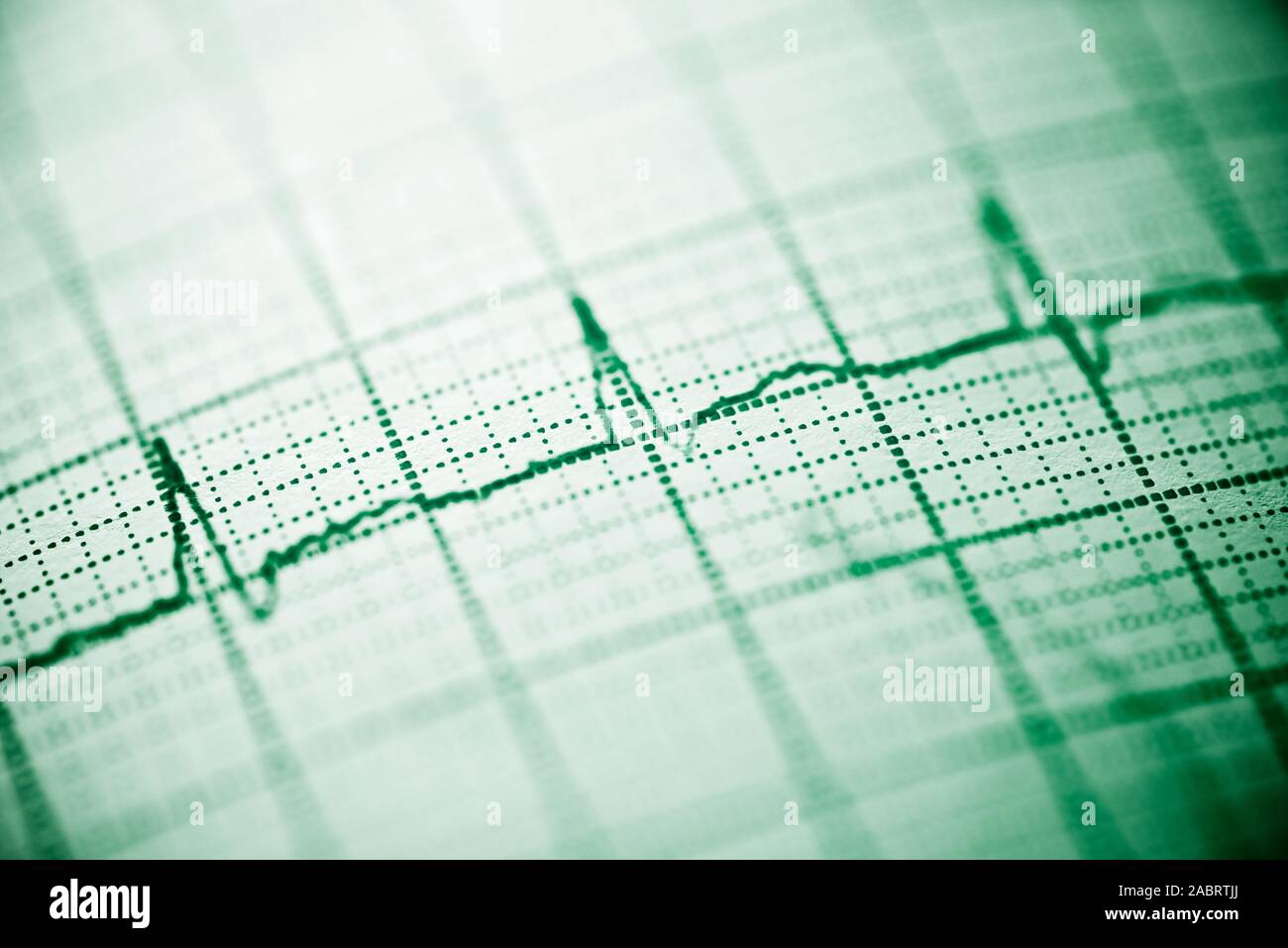 Ekg paper close up hi-res stock photography and images - Alamy