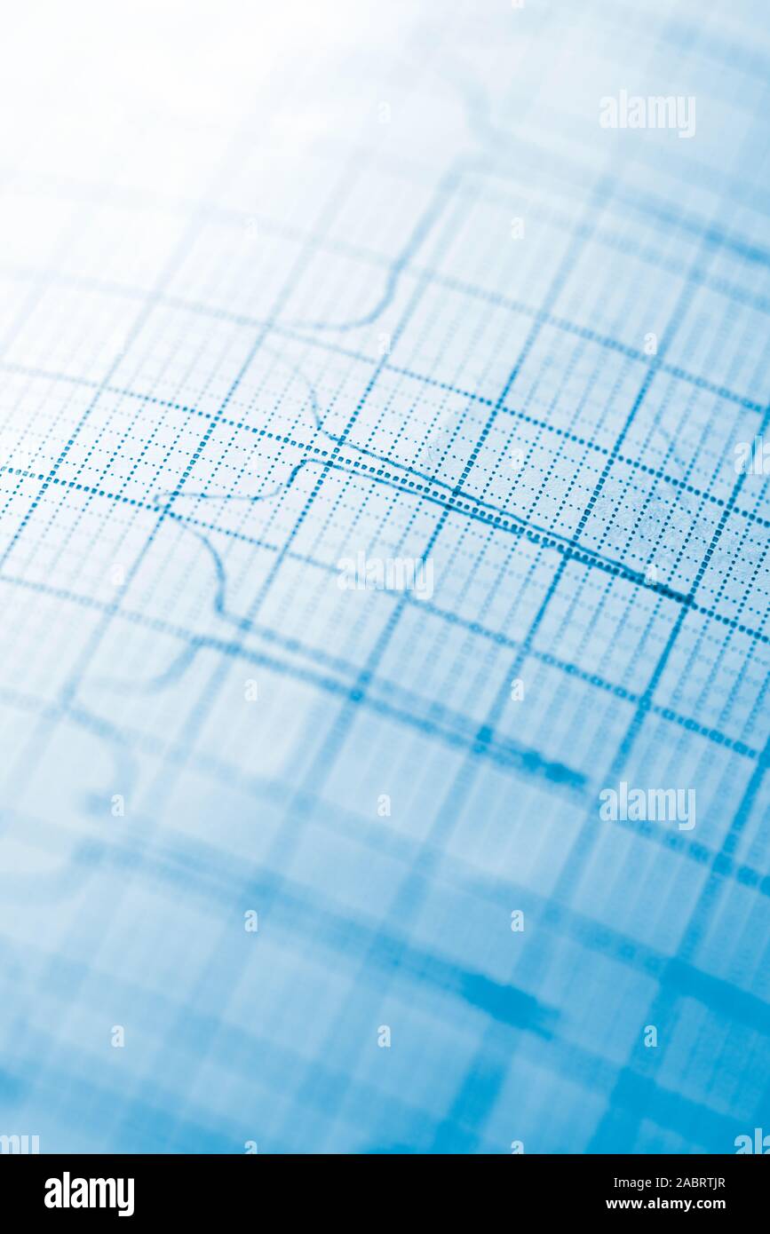 Close up of an electrocardiogram in paper form Stock Photo - Alamy