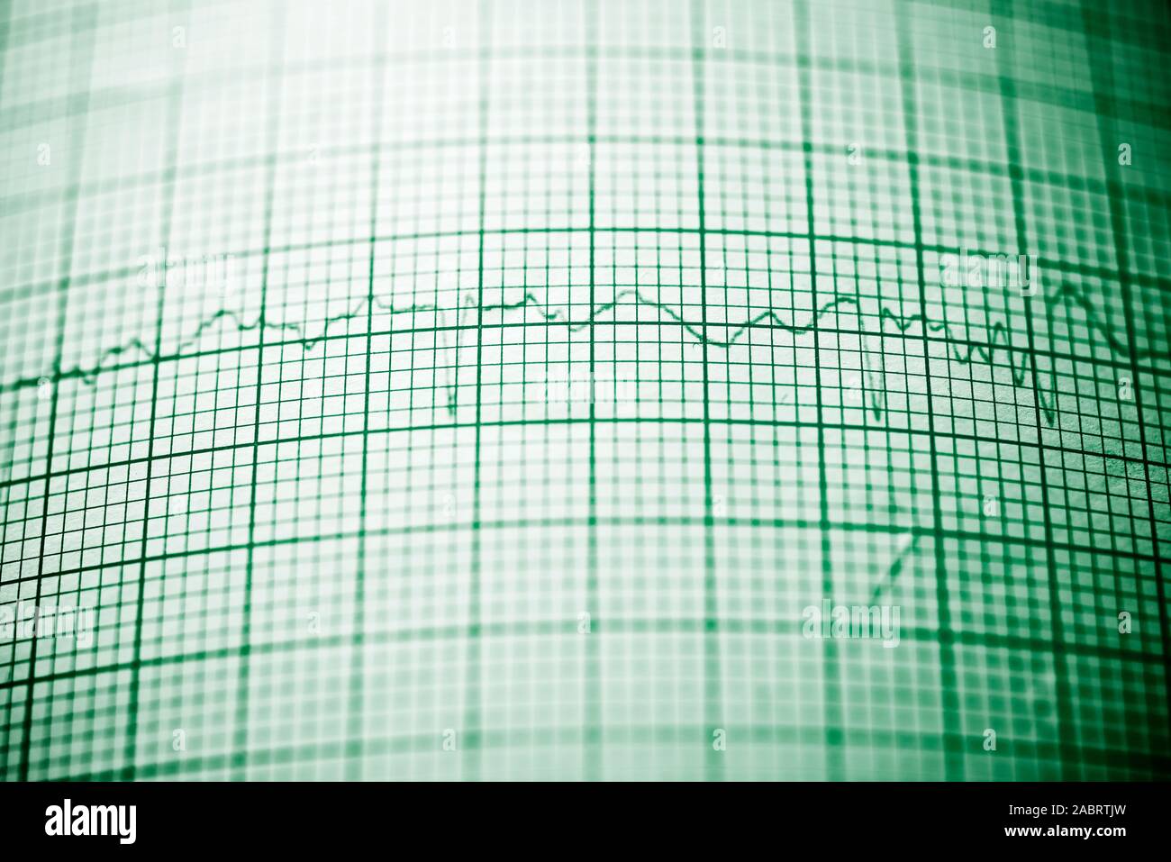 Close up of an electrocardiogram in paper form Stock Photo - Alamy