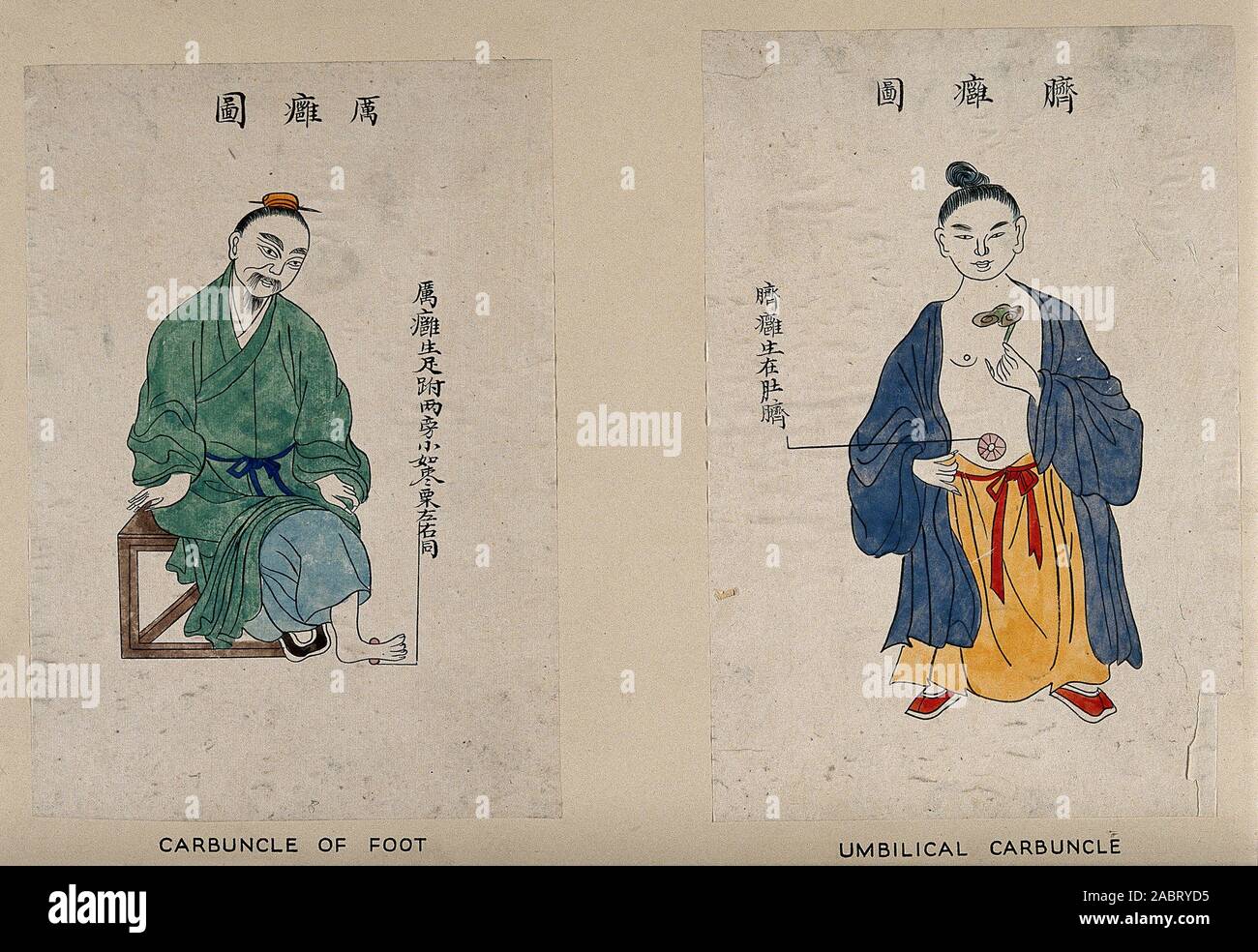 Carbuncle Art High Resolution Stock Photography and Images - Alamy