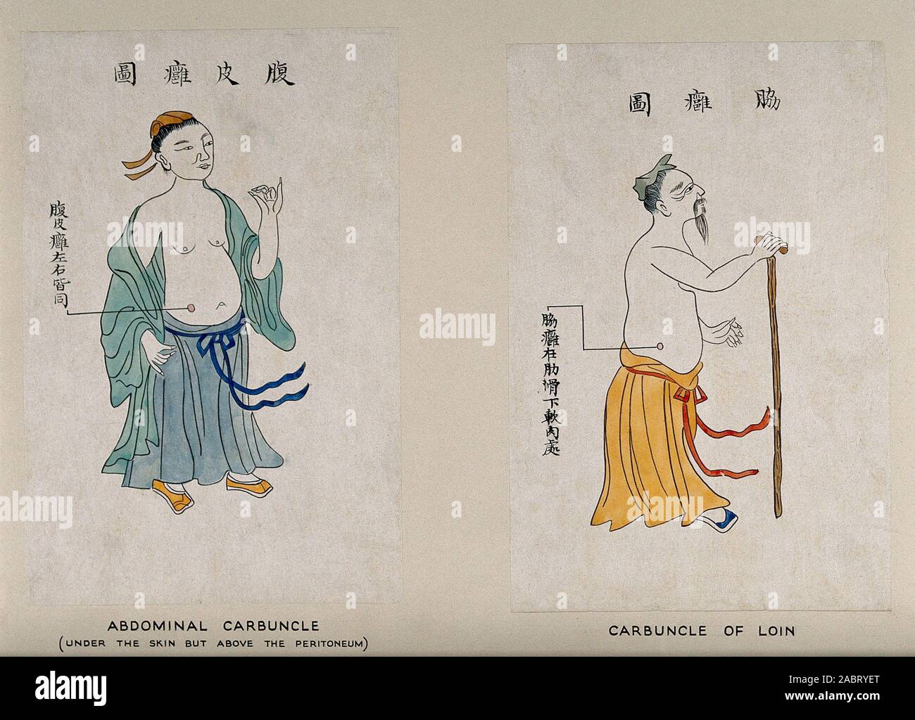 Carbuncle Art High Resolution Stock Photography and Images - Alamy