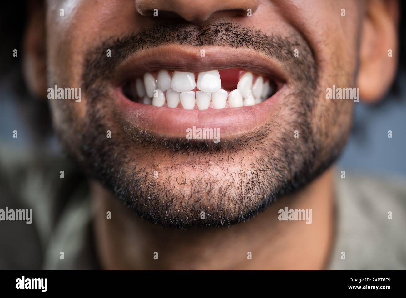 Black Man Smiling With No Teeth