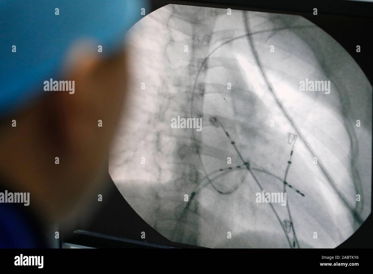 Cardiology Hospital. Diagnostic radiology. Angiography. Ho Chi Minh ...