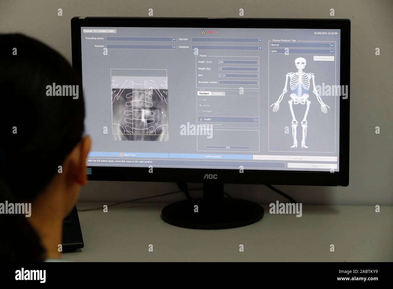 Medix 90 a tool for routine osteoporosis and fracture risk assessment ...