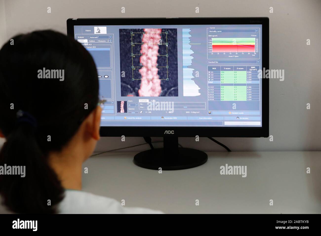 Medix 90 a tool for routine osteoporosis and fracture risk assessment ...