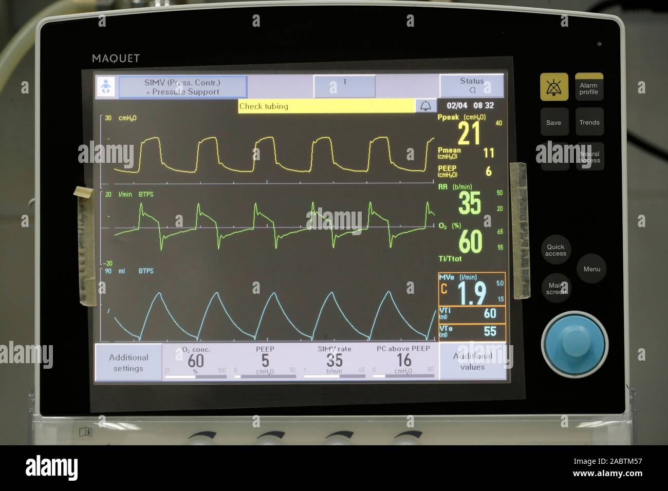 Hospital. Operating theater. Cardiac surgery. Scope. Heart monitor. Ho ...