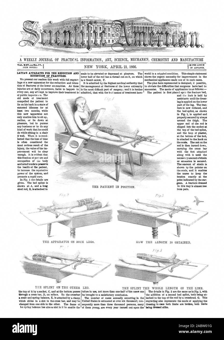Splint lab hi-res stock photography and images - Alamy