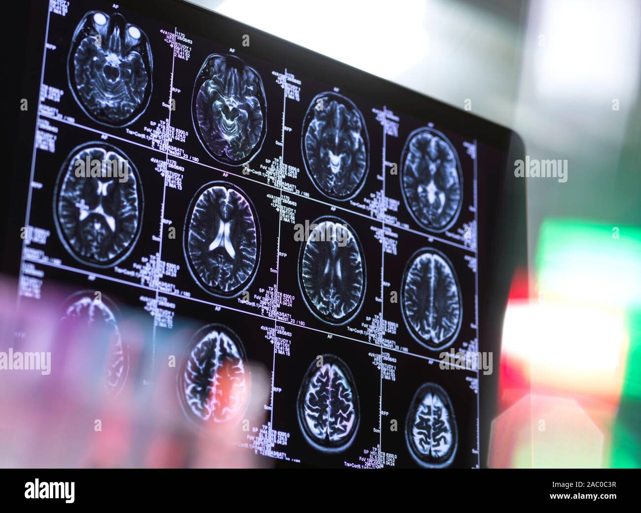 Human brain scan being analysed in a neurology clinic Stock Photo - Alamy