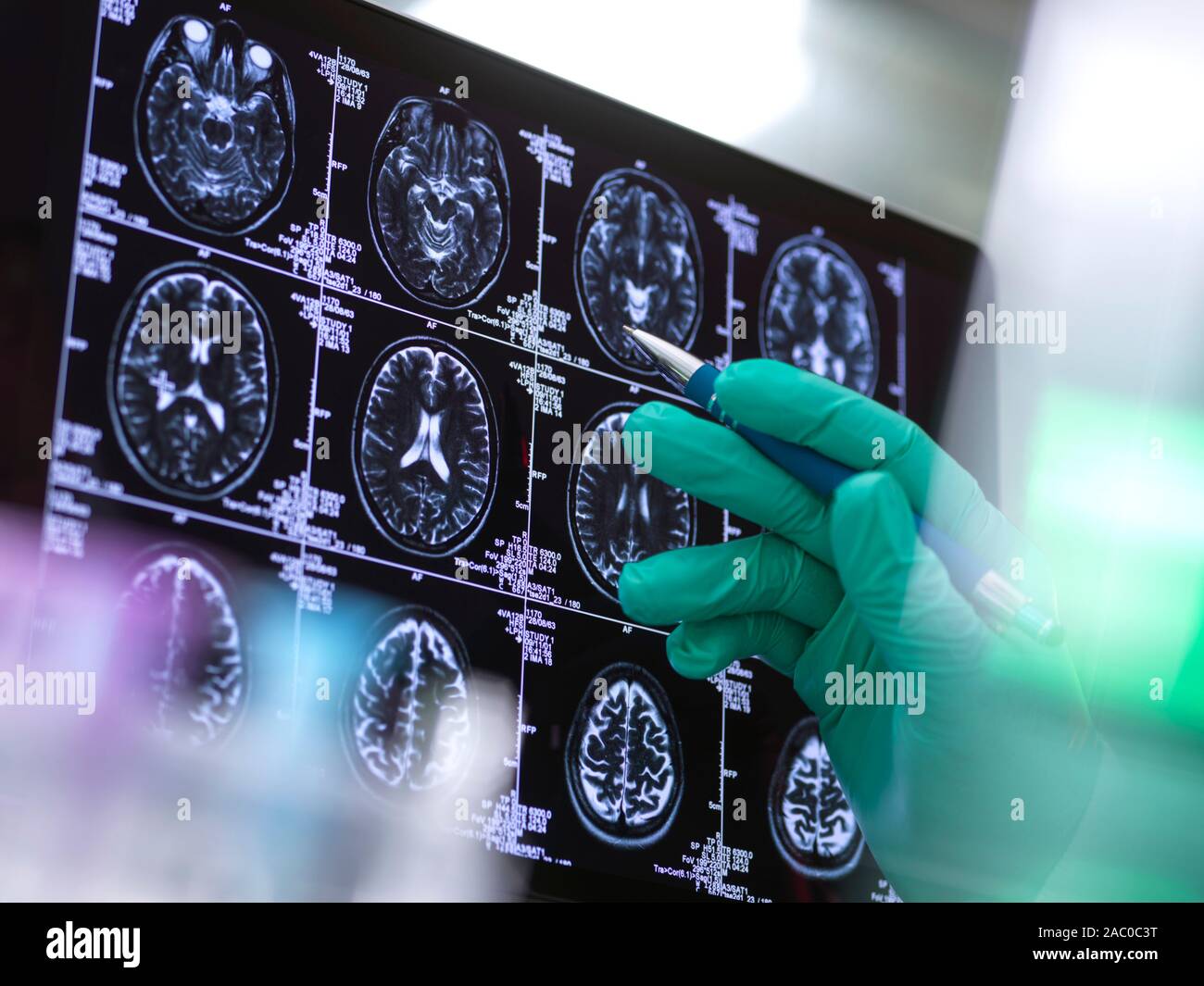 Human brain scan being analysed in a neurology clinic Stock Photo - Alamy