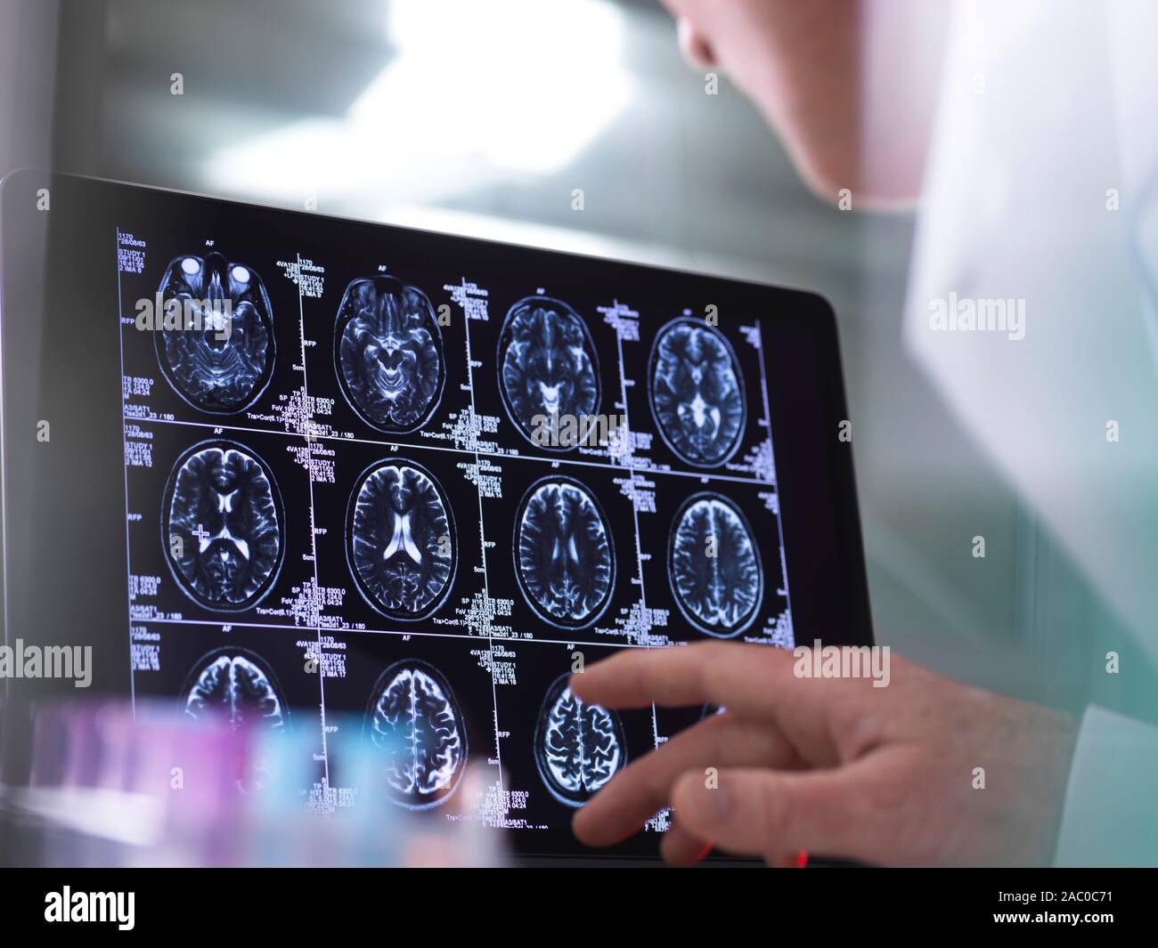 Human brain scan being analysed in a neurology clinic Stock Photo - Alamy
