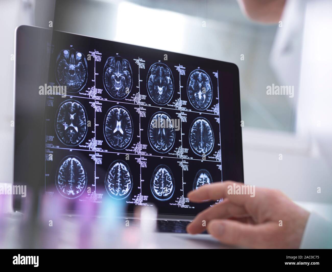 Human brain scan being analysed in a neurology clinic Stock Photo - Alamy