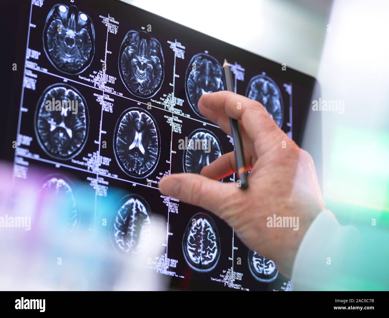 Human brain scan being analysed in a neurology clinic Stock Photo - Alamy