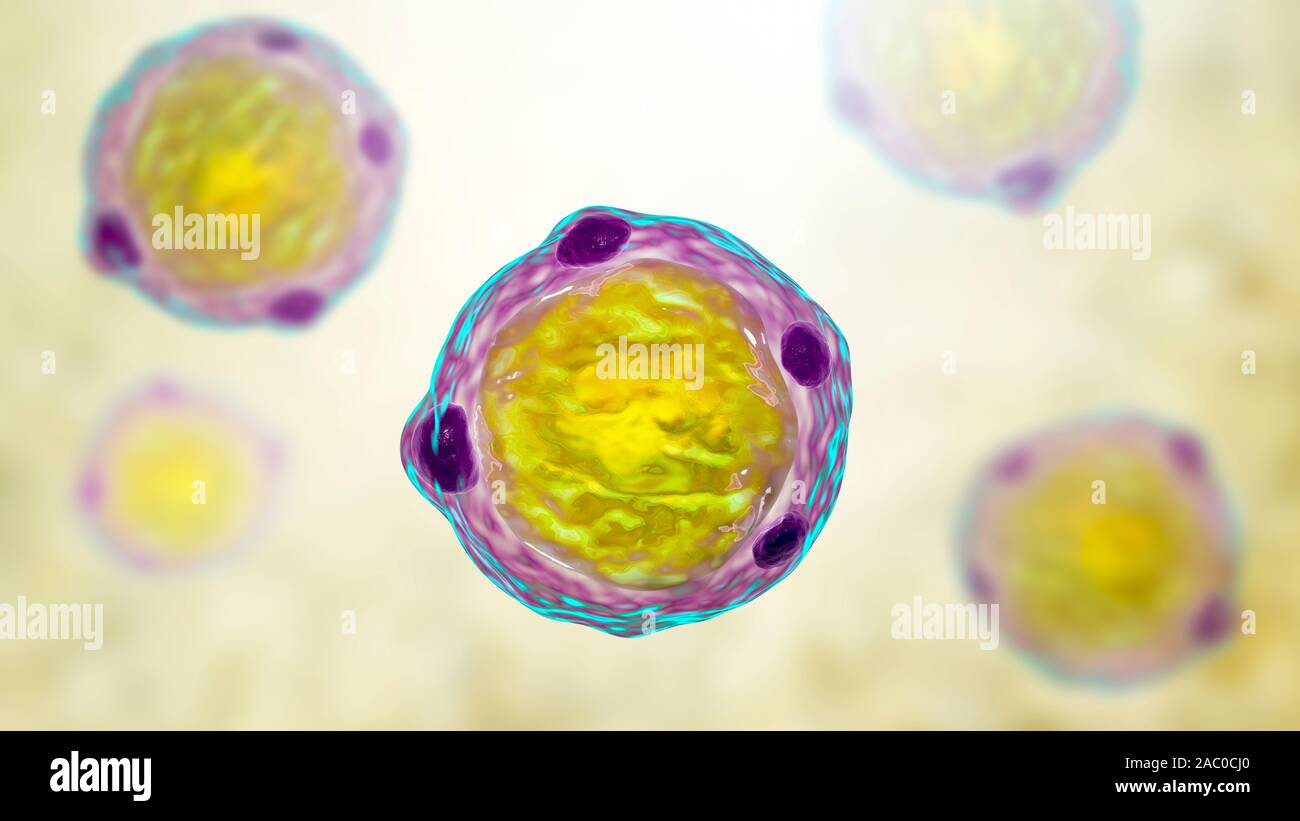 Blastocystis hominis parasite, computer illustration. A causative agent ...