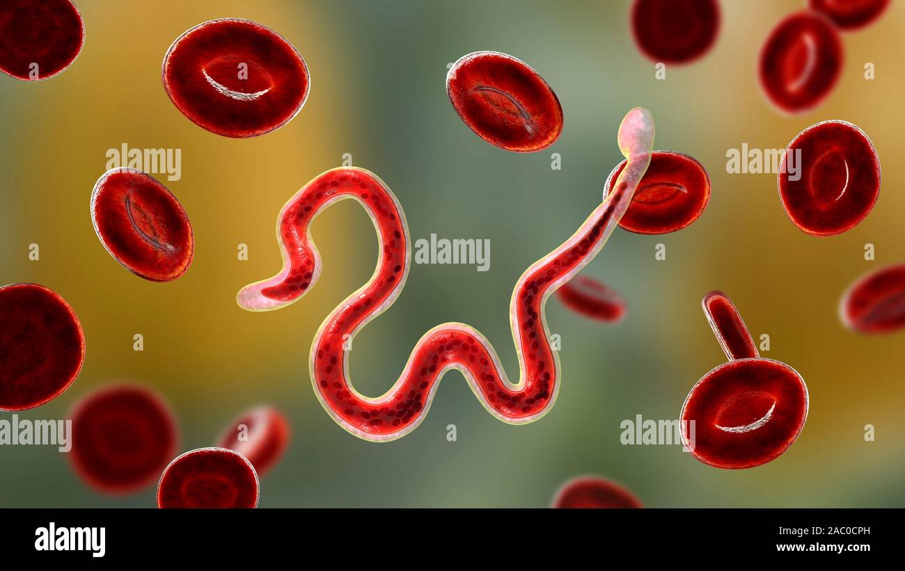 Computer illustration of Brugia malayi a parasitic nematode worm and ...
