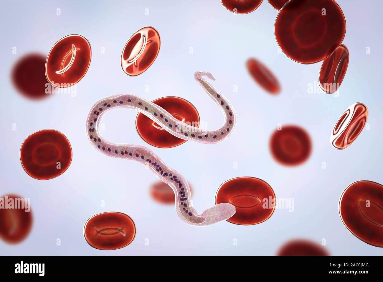 Wuchereria bancrofti parasite, illustration Stock Photo - Alamy