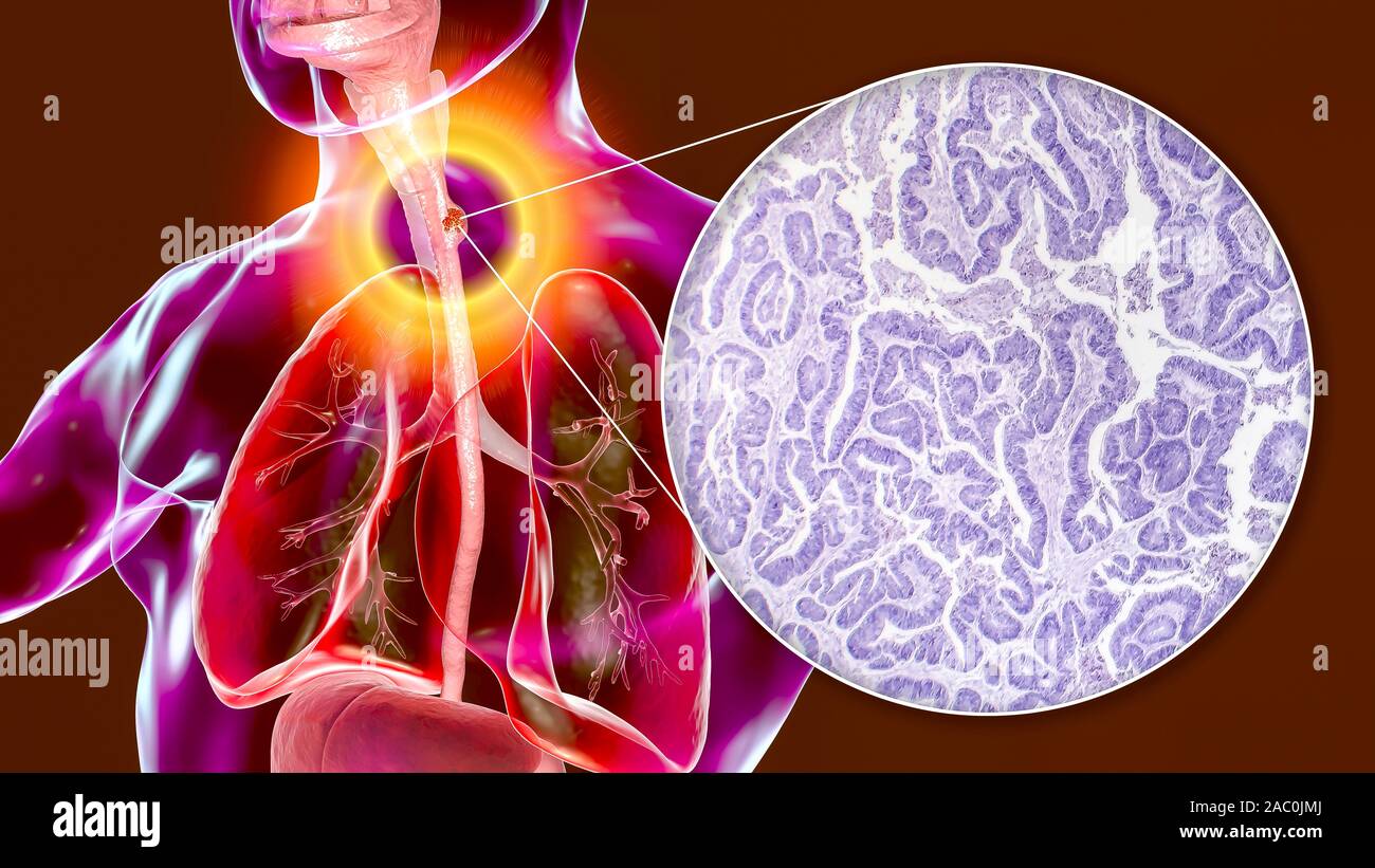 Digestive tract micrograph hi-res stock photography and images - Alamy