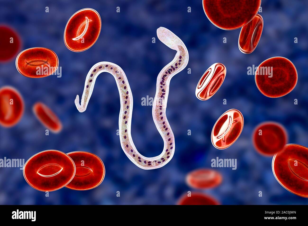 Wuchereria Bancrofti