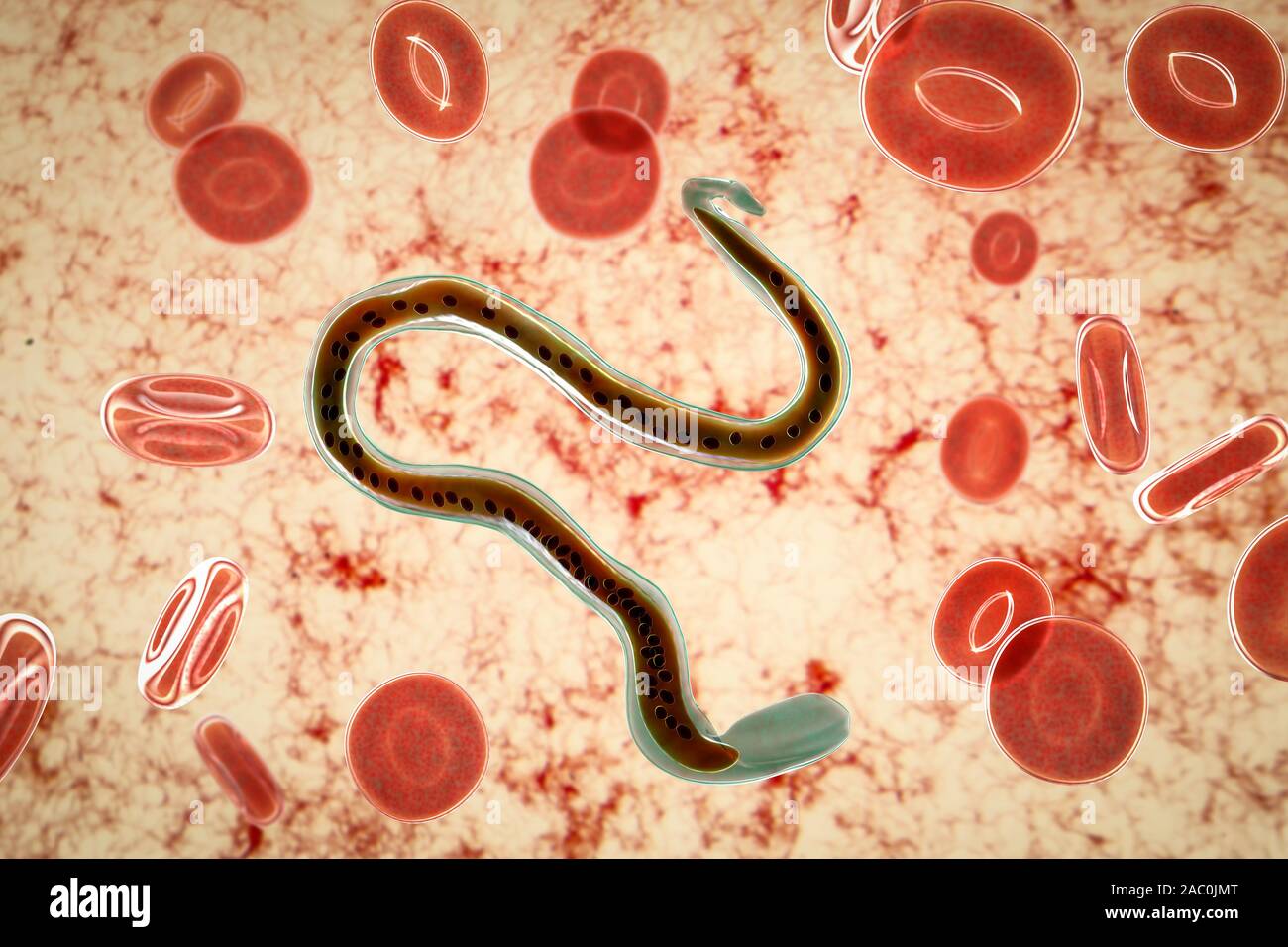 Wuchereria bancrofti parasite, illustration Stock Photo - Alamy
