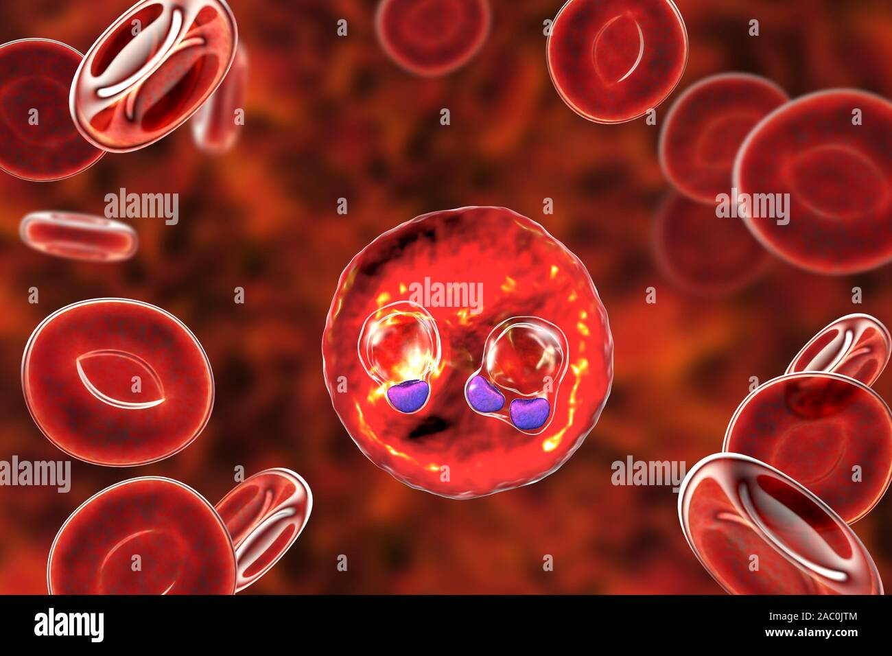 Protozoan Plasmodium falciparum in the stage of ring form tr Stock ...