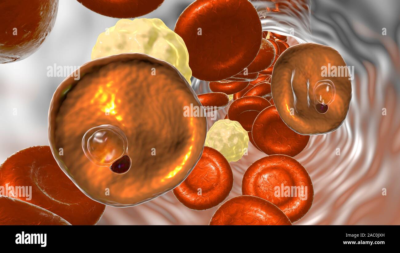 Plasmodium vivax inside red blood cells, illustration Stock Photo - Alamy