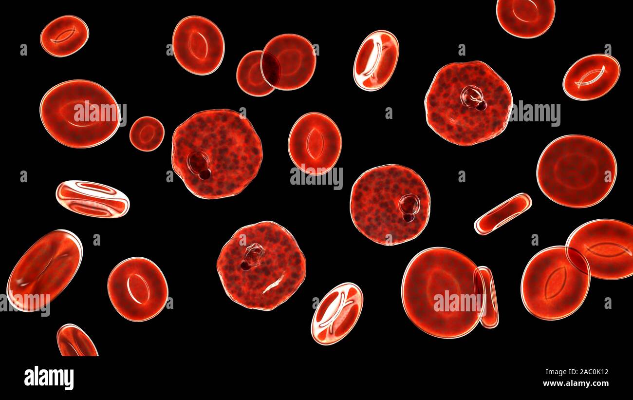 Plasmodium vivax inside red blood cells, illustration Stock Photo - Alamy