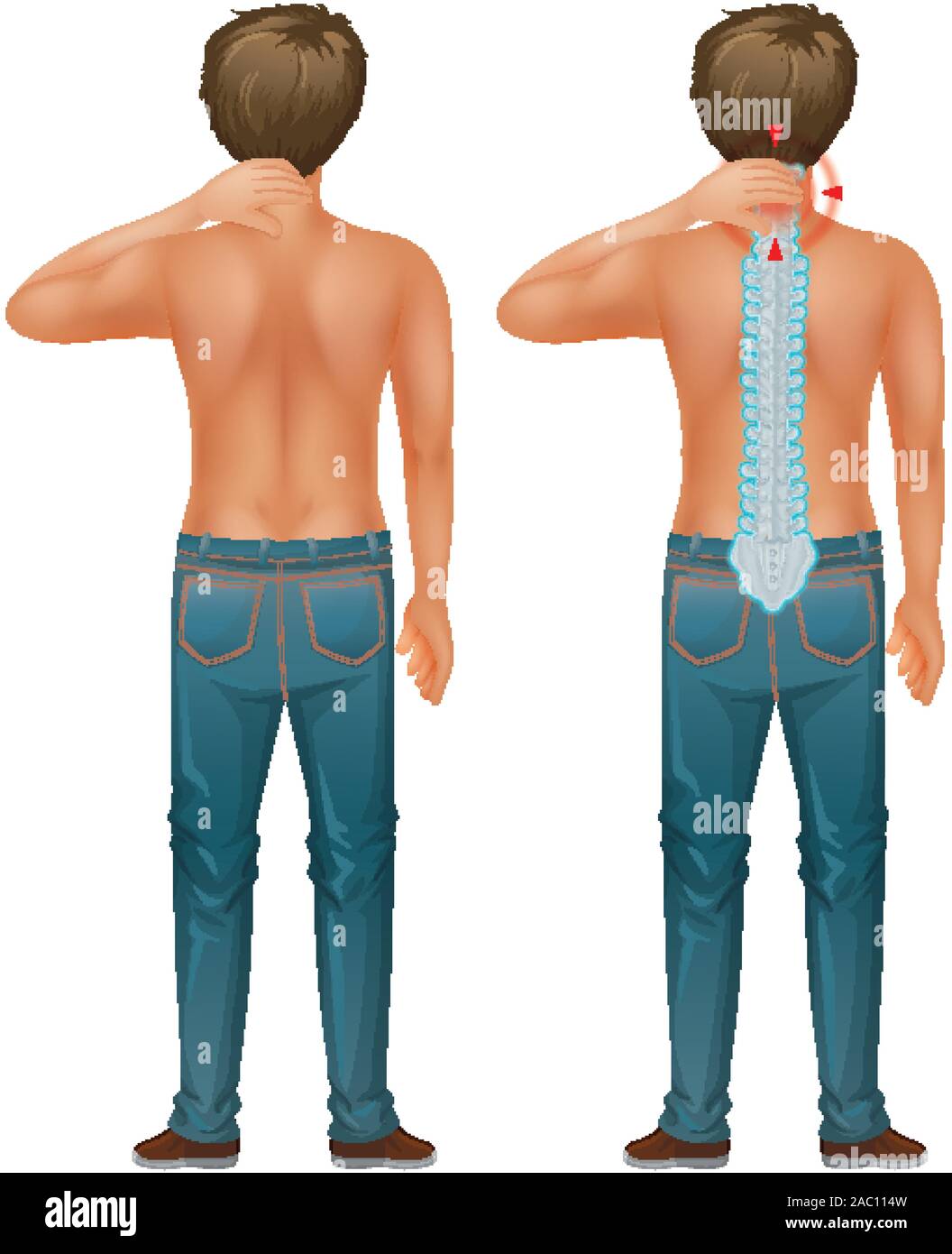 Back of man with spinal nerve problem illustration Stock Vector Image ...