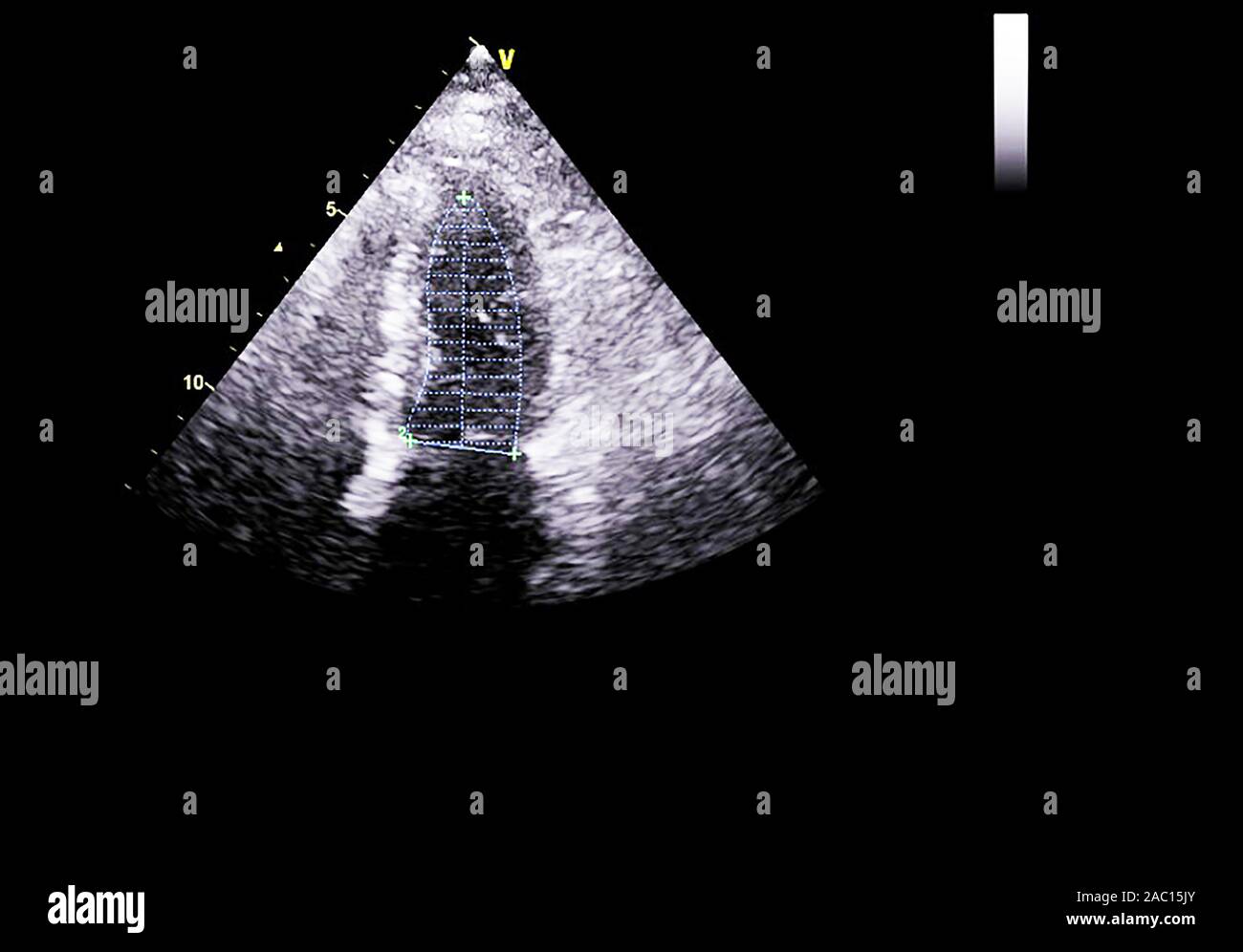Screen of an ultrasound machine with a heart image Stock Photo - Alamy