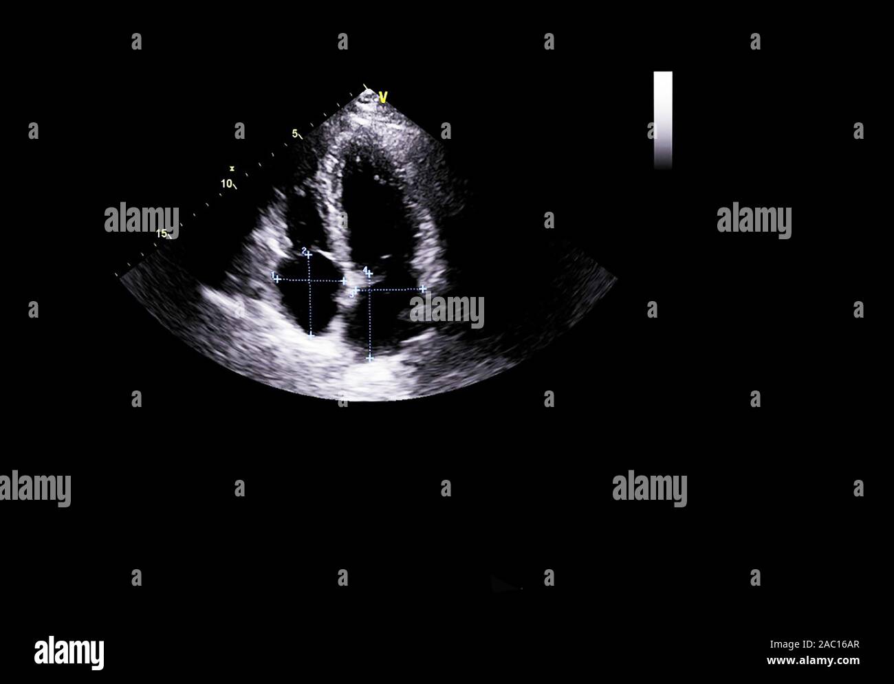 Screen of an ultrasound machine with a heart image Stock Photo - Alamy