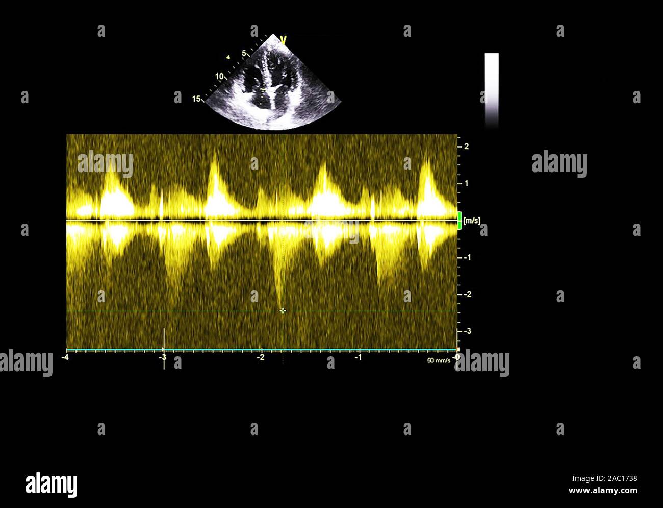 Screen of an ultrasound machine with a heart image Stock Photo - Alamy
