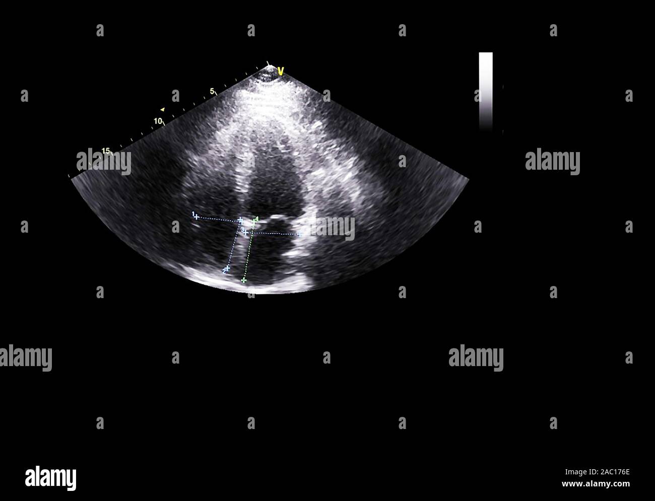 Screen of an ultrasound machine with a heart image Stock Photo - Alamy