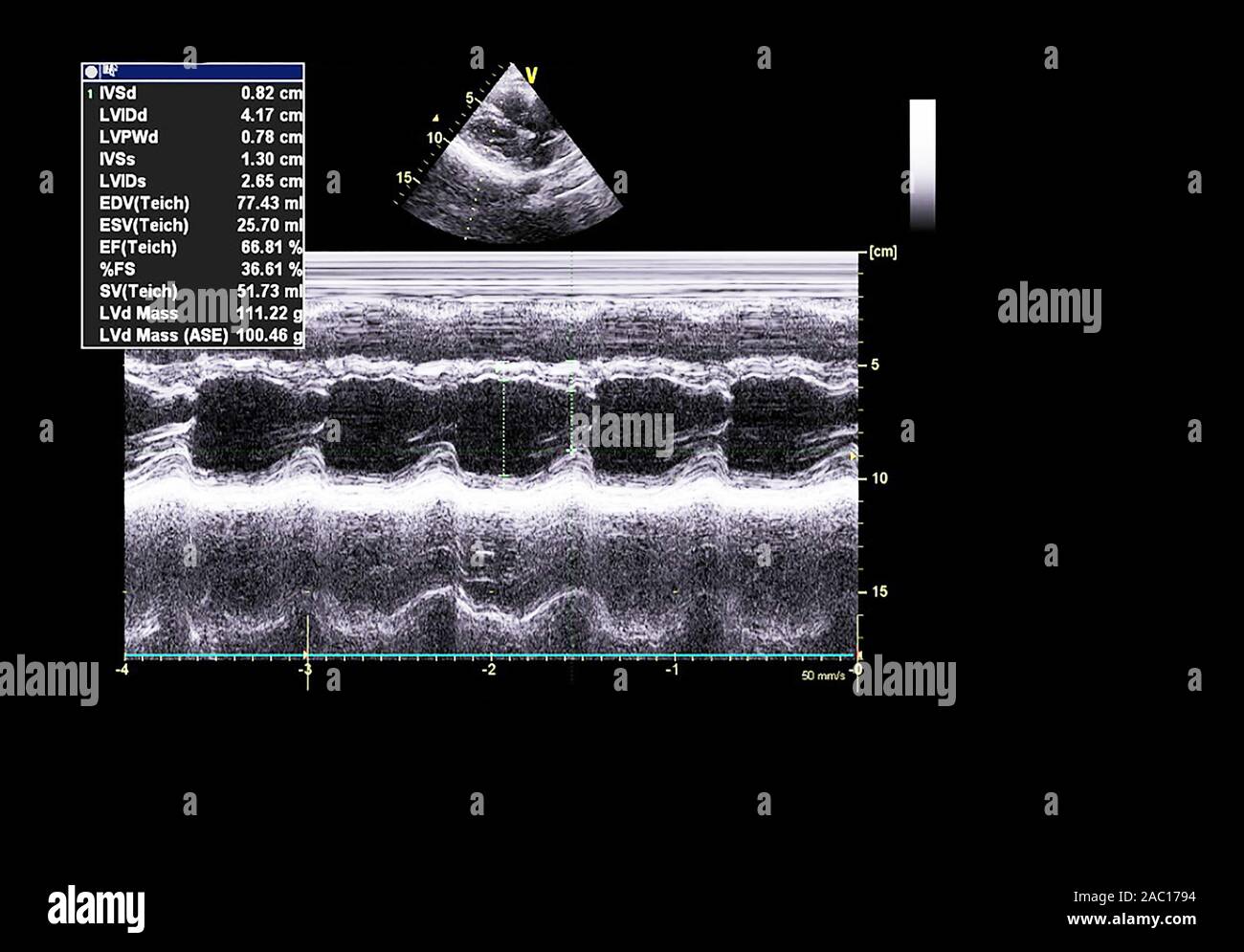 Screen of an ultrasound machine with a heart image Stock Photo - Alamy