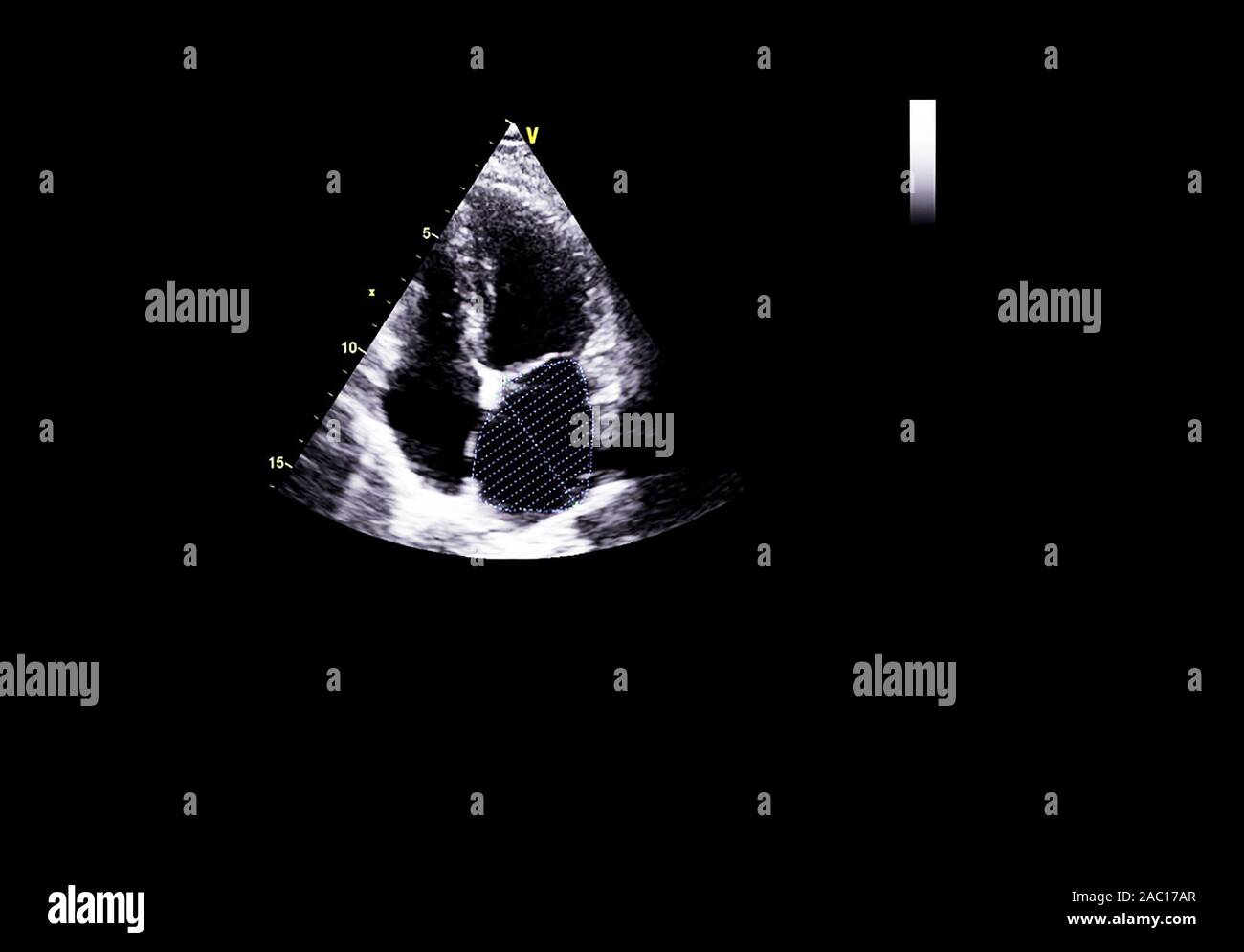 Screen of an ultrasound machine with a heart image Stock Photo - Alamy