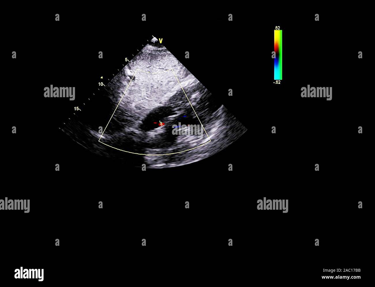 Screen of an ultrasound machine with a heart image Stock Photo - Alamy