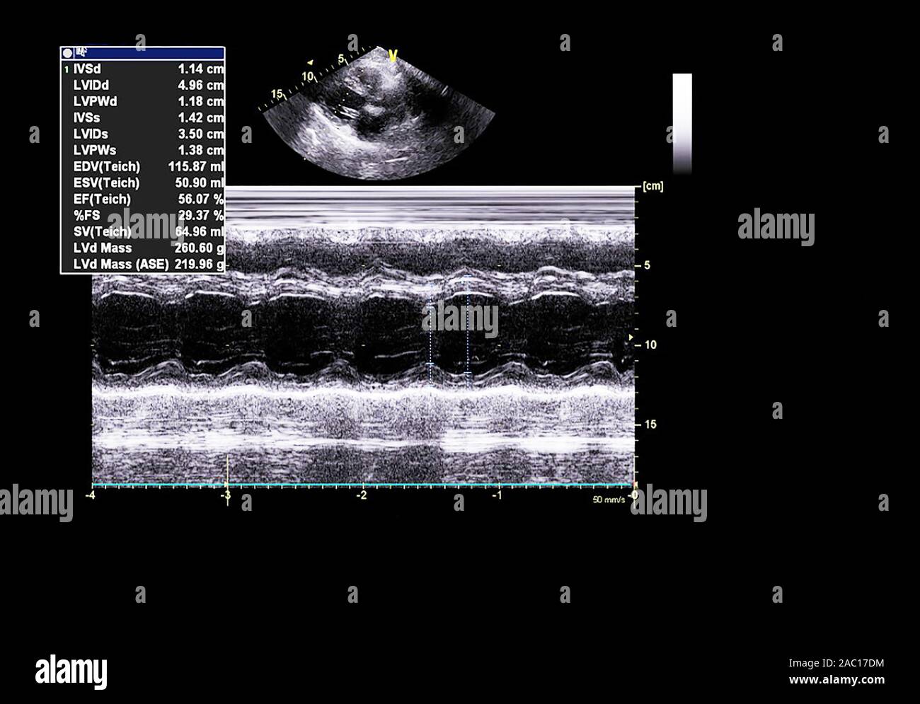 Screen of an ultrasound machine with a heart image Stock Photo - Alamy