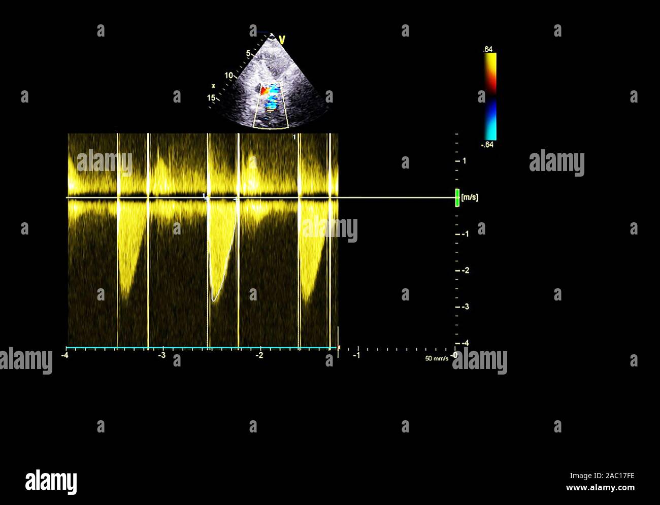 Screen of an ultrasound machine with a heart image Stock Photo - Alamy